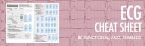 Ecg Interpretation Made Easy Pdf | amulette