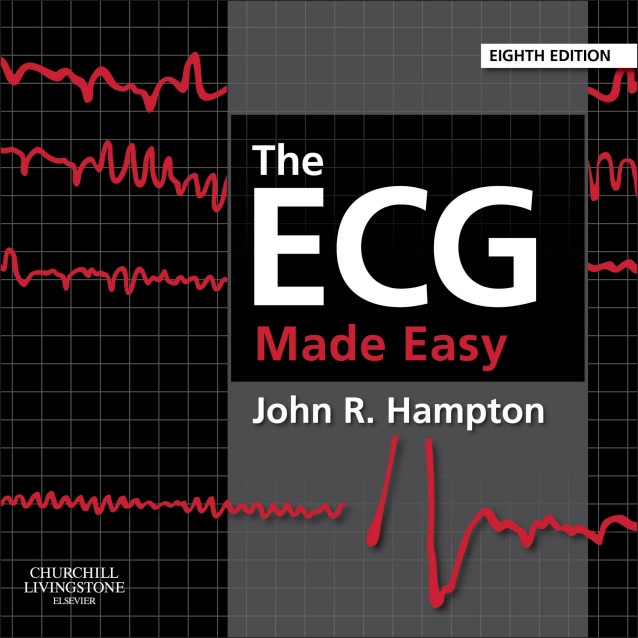Ecg Interpretation Made Easy Pdf | amulette